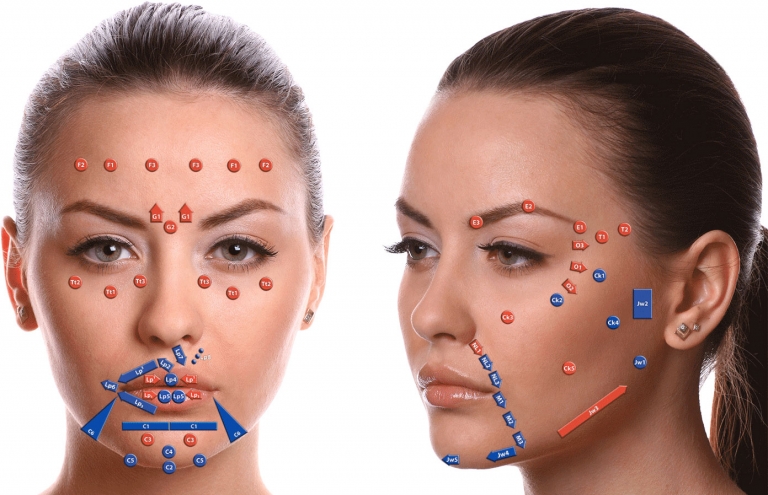 Dermal Fillers in Prince George, BC | Nova MD